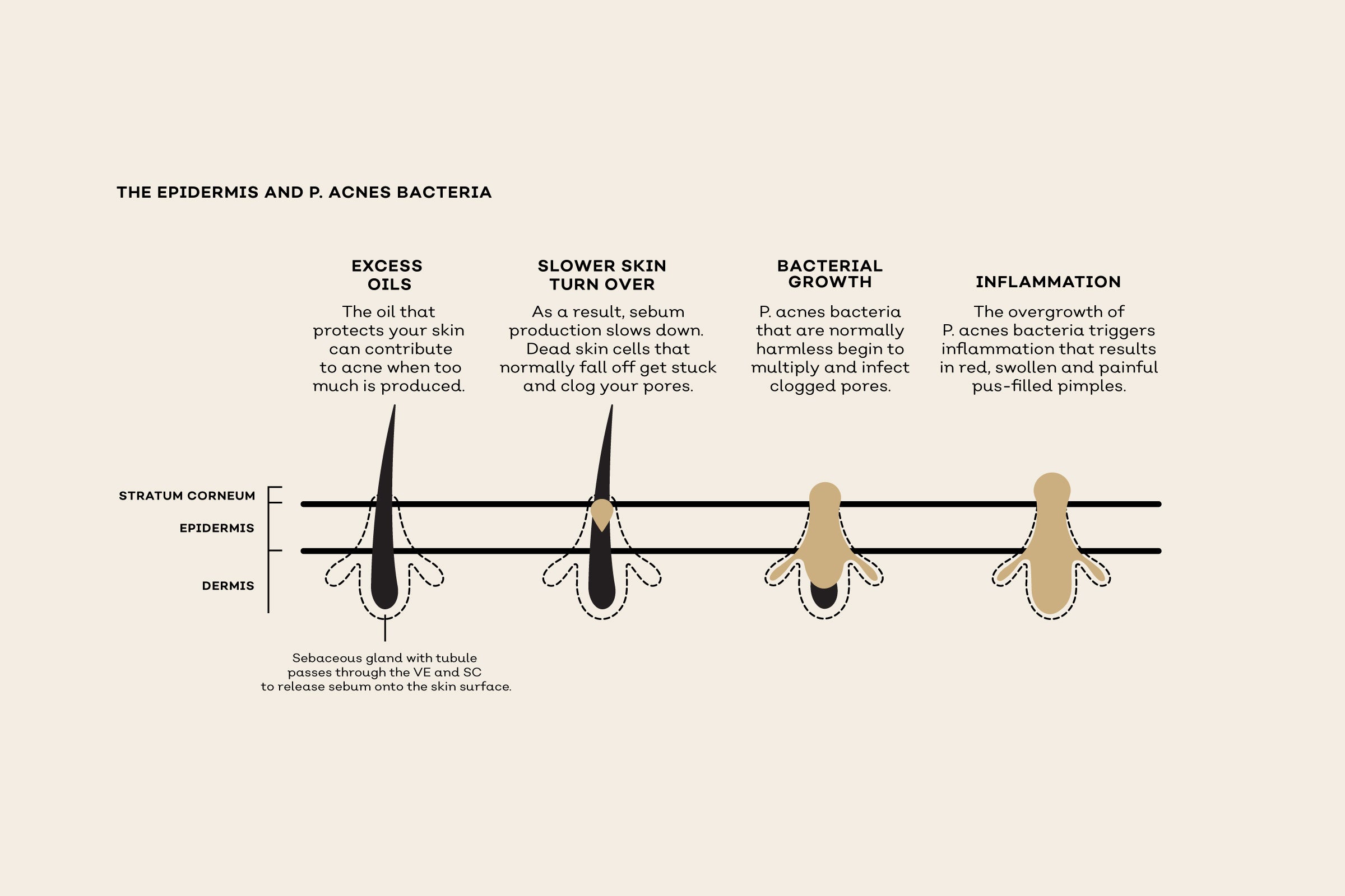 The Science Of Skincare – ISOOSI